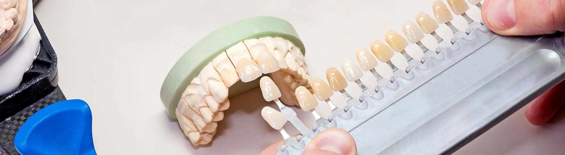 PFM CROWNS VS ALL-CERAMIC CROWNS: PROS AND CONS - Estatica Dental Lab